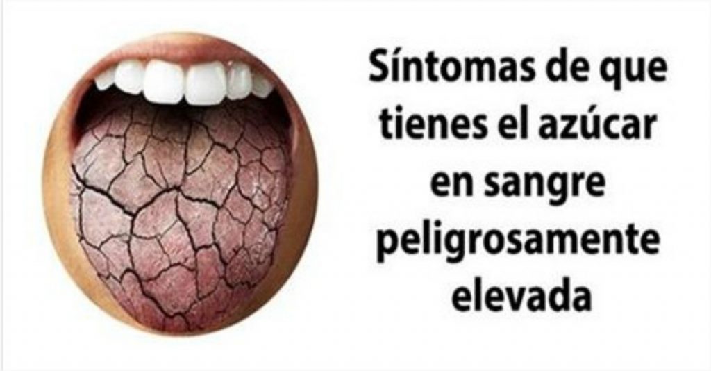 14 Síntomas Que Te Indican Que Tienes Los Niveles De Azúcar Muy Altos ...