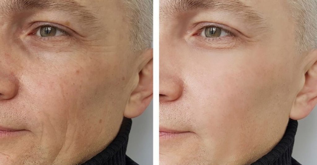 Autofagia: Qué Es Y Cómo Potenciarla Para Rejuvenecer Tus Células ...