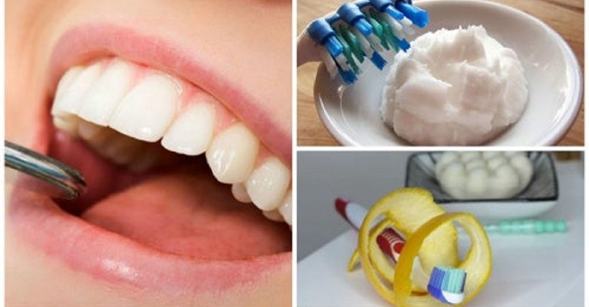 6 Tips Caseros Para Quitar El Sarro Acumulado En Tus Dientes | Delicias ...